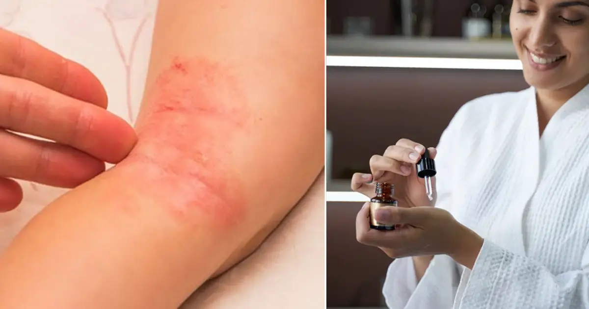 Does Castor Oil Kill Candida Castor Oil Guide
